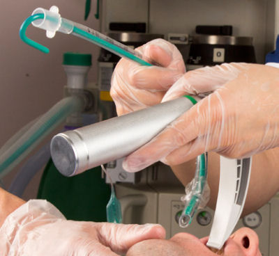 InterForm intubating stylet